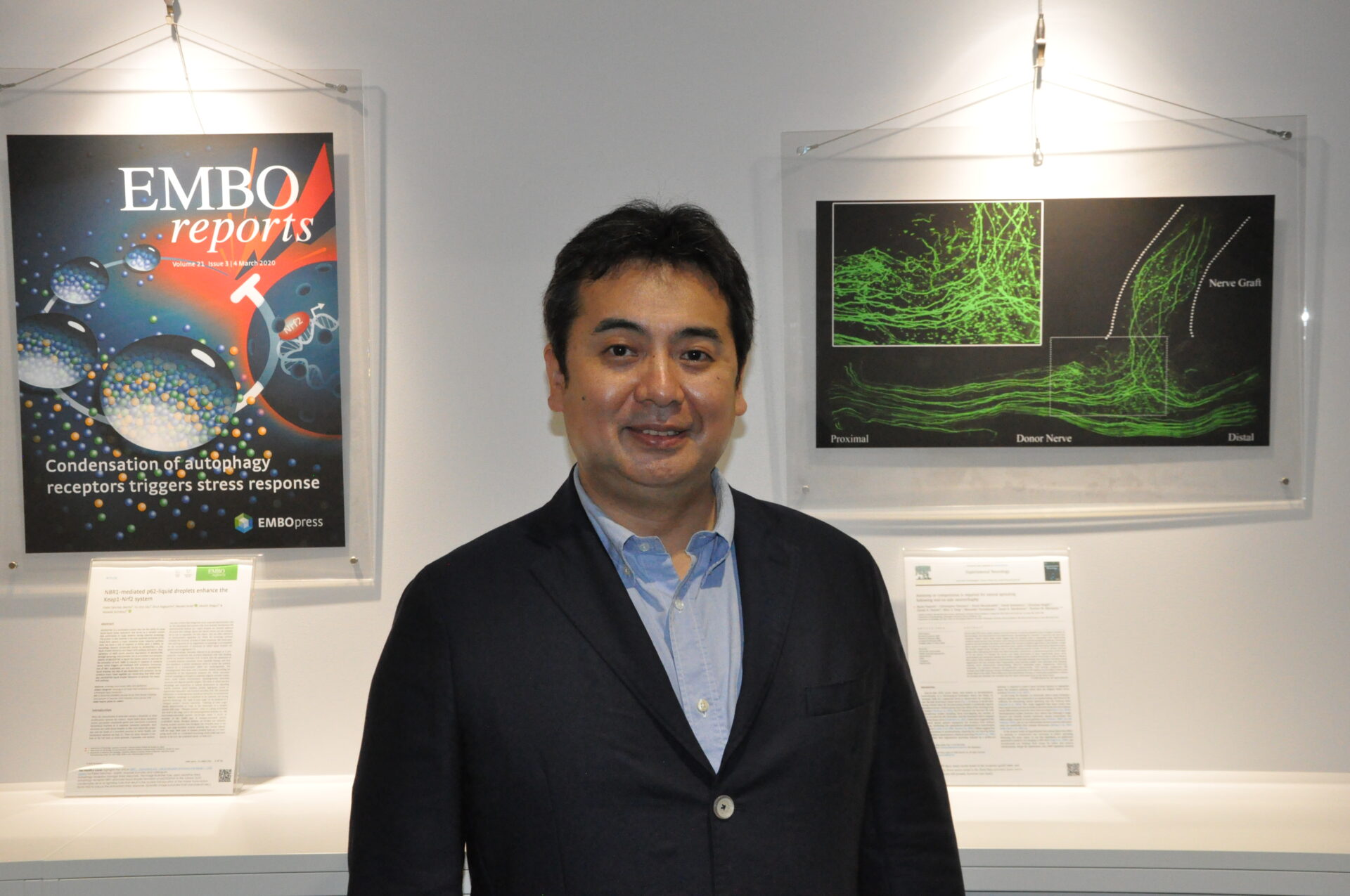 脳室内投与のためのリザーバ留置手術とは｜教えて！ムコタ先生〜ムコ多糖症相談室〜