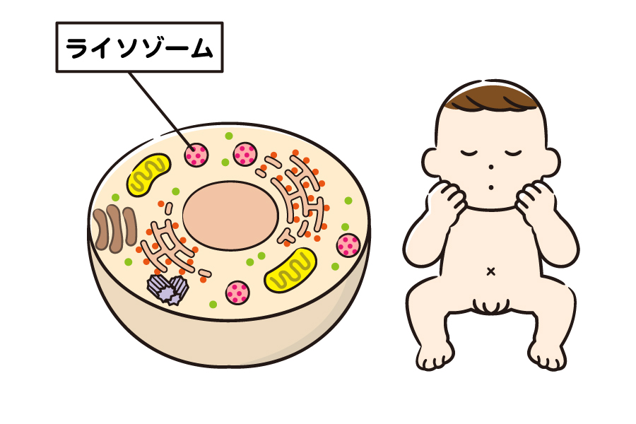 拡大新生児マススクリーニングとは？｜教えて！ムコタ先生〜ムコ多糖症相談室〜